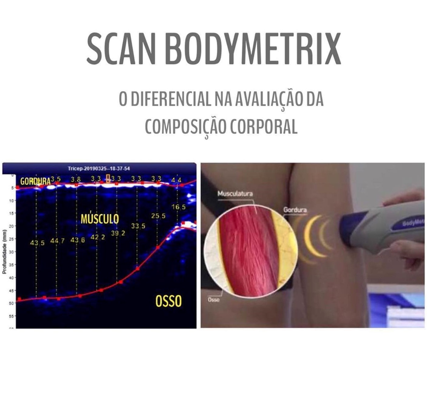 Avaliação por Ultrassom – Erica Sena Nutricionista